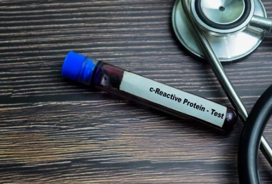 Proteína C Reactiva Ultra sensible | PCR-US | Omedic – Omedic